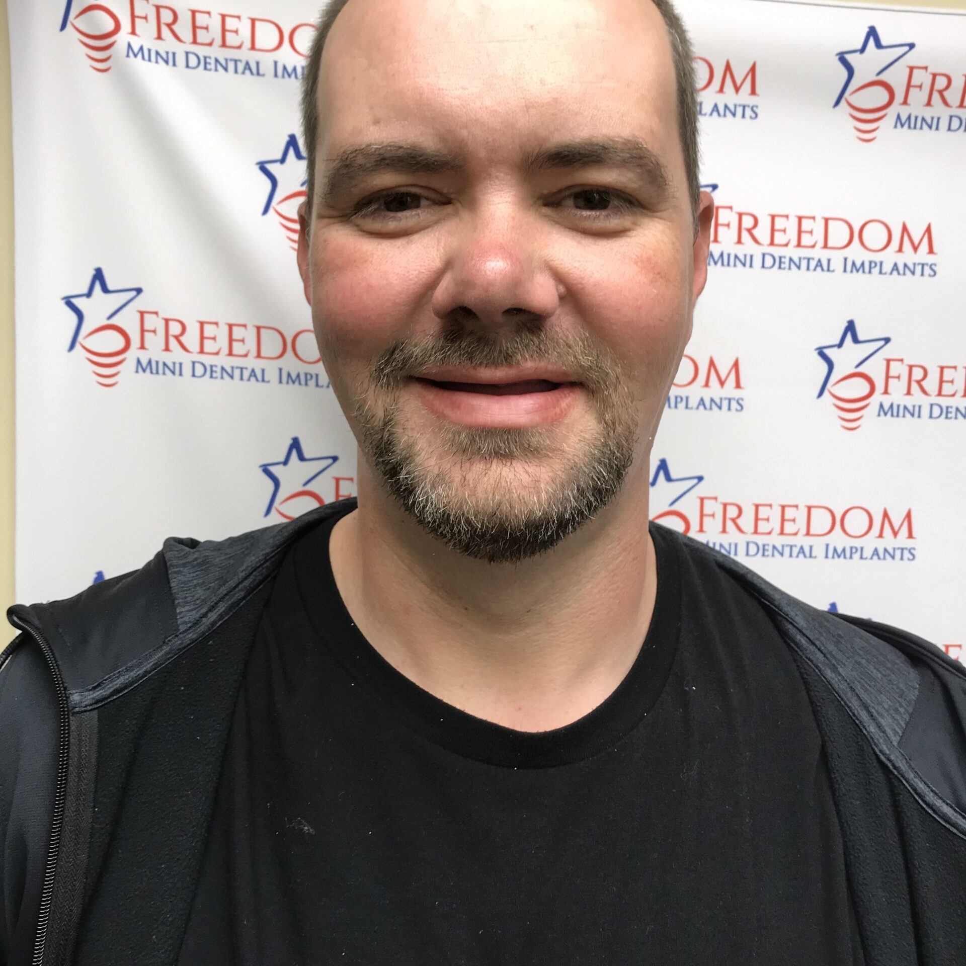 Freedom Mini Dental Implants | Home | KY 40291